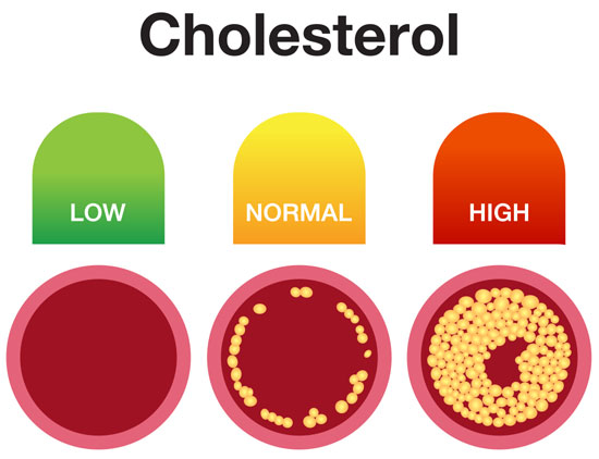 Cholesterol and Your Health - How Low Should Your Cholesterol Go?