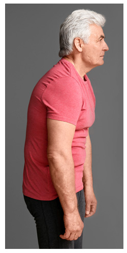 Rounded Shoulders - Correcting Rounded Shoulders for a Fitter Appearance